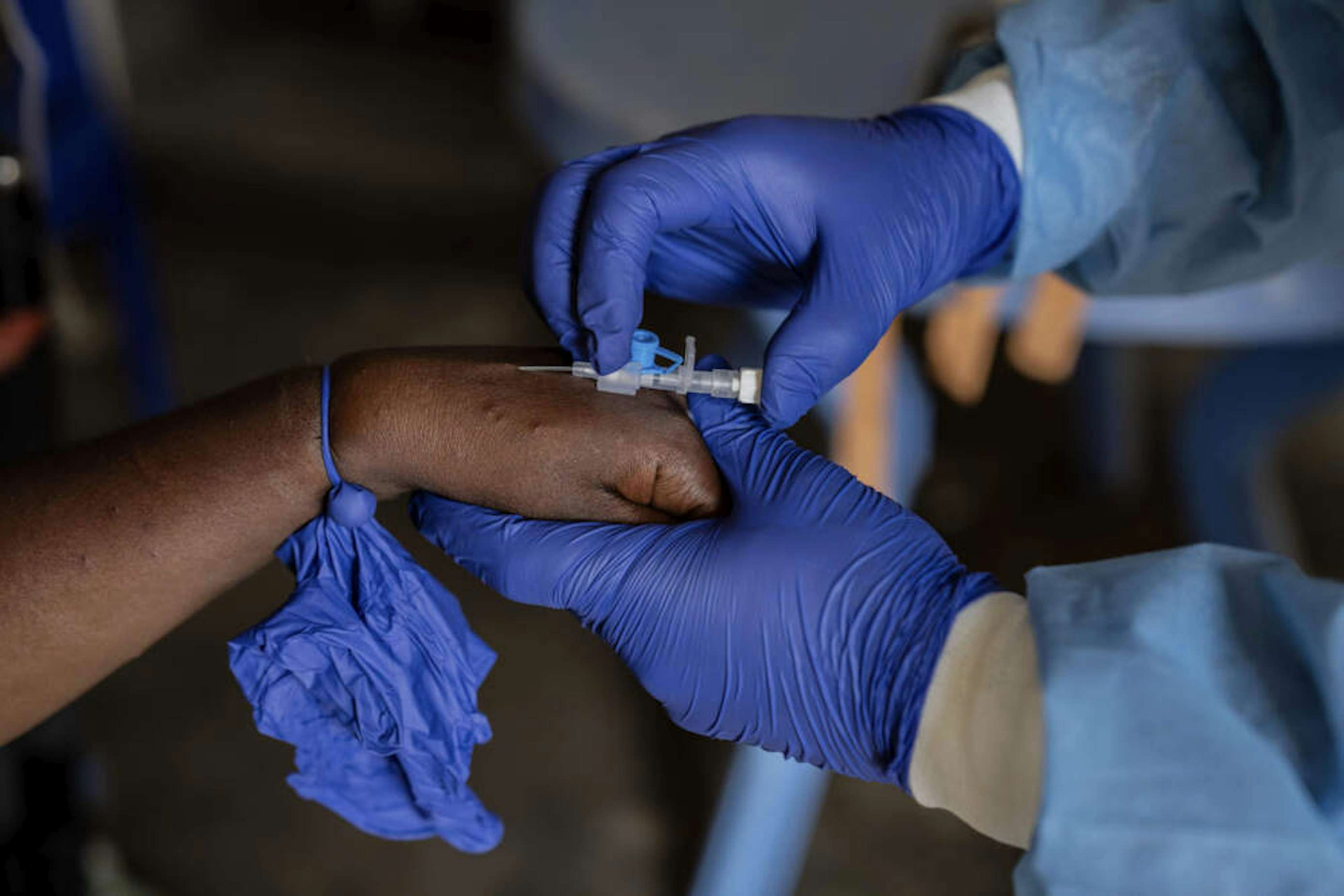 Kuow What You Need To Know About The New Mpox Variant