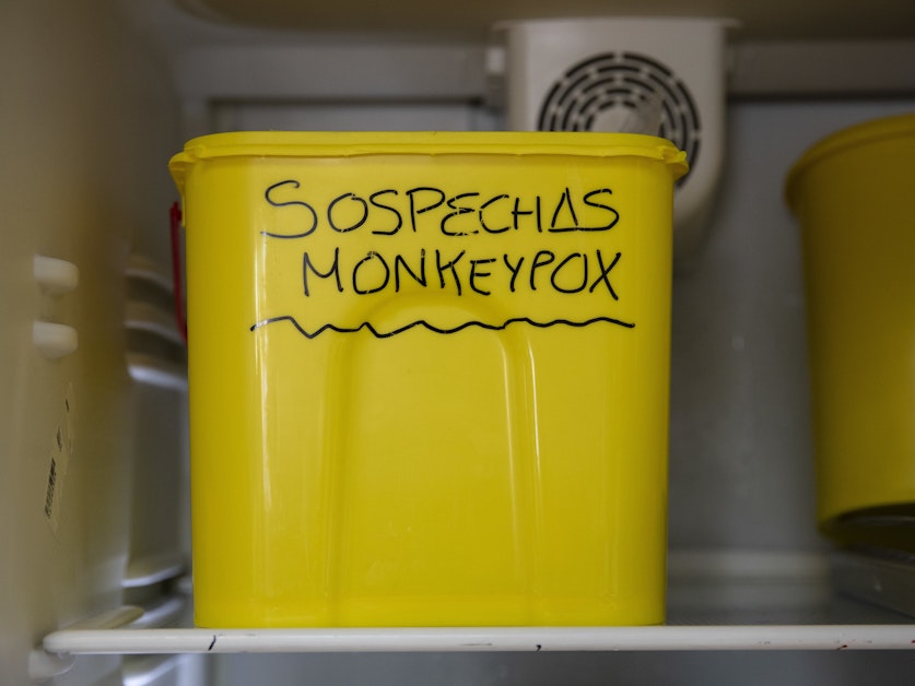 KUOW - The monkeypox outbreak was avoidable and warning signs were ... KUOW - The monkeypox outbreak was avoidable and warning signs were ...